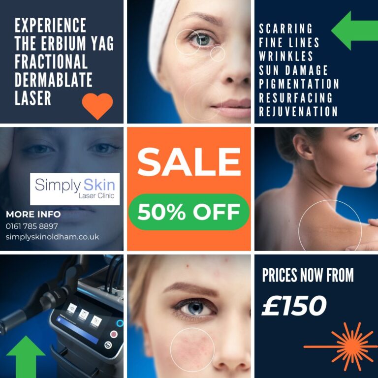 Dermablate Fractional Laser - Simply Skin Oldham